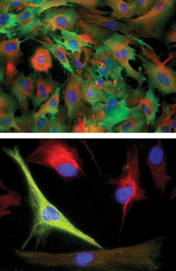 Extracts - Normal Brain Cells Morph Like Stem Cells